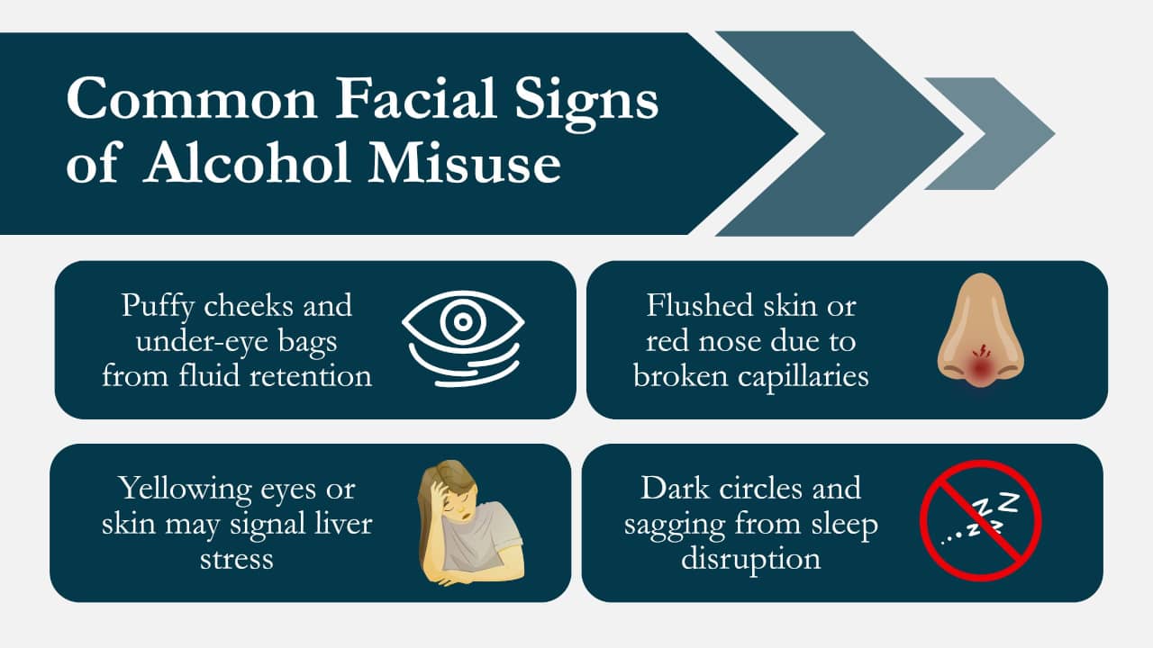How to Spot an Alcoholic Face: Signs, Causes, and What to Do
